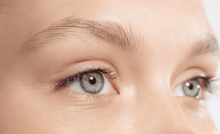 What Is Meibomian Gland Dysfunction (MGD)What Is Meibomian Gland ...