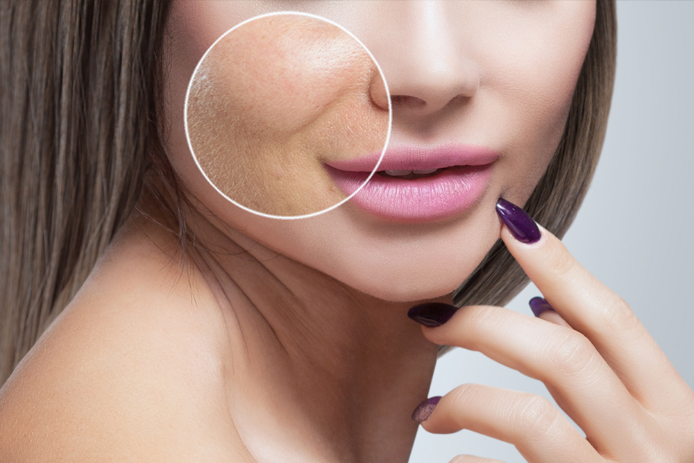 VISIA Skin Analysis - Bright Eye Spa + Medical Aesthetics