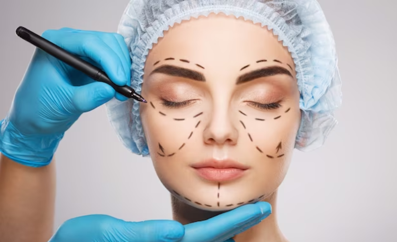 Radiofrequency Microneedling